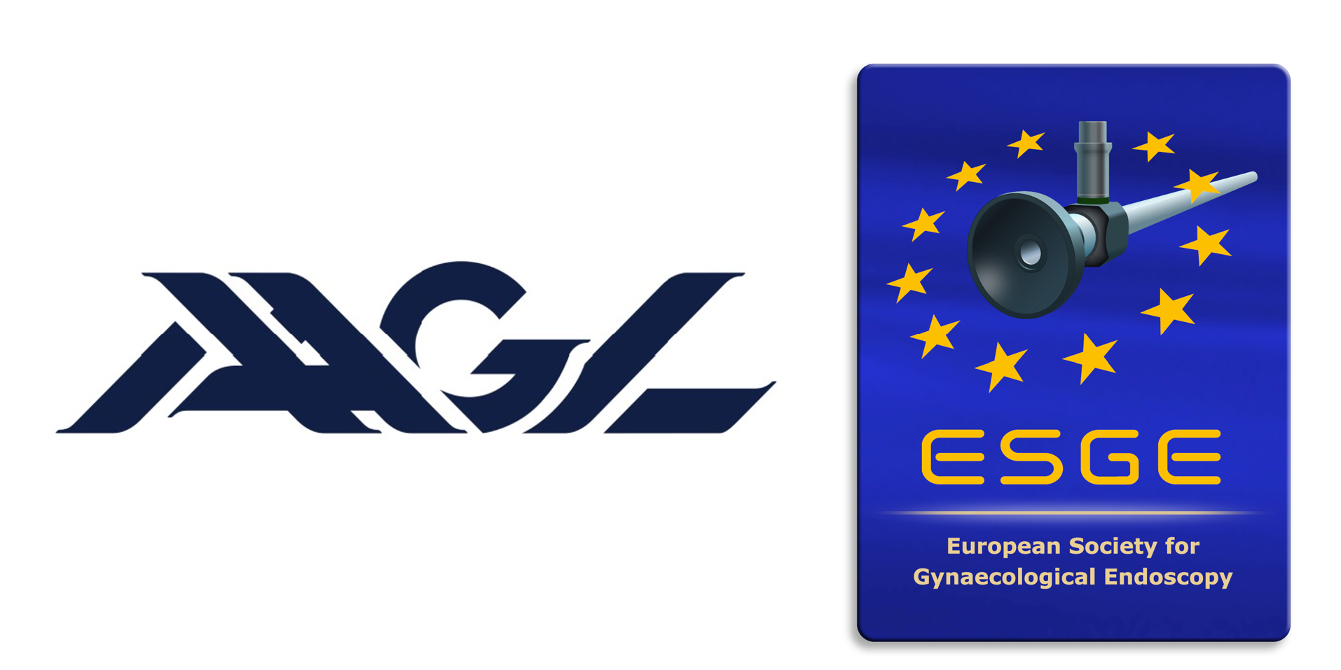 The AAGL/ESGE Webinar Series - Webinar #1: Role of Hysteroscopy in ...